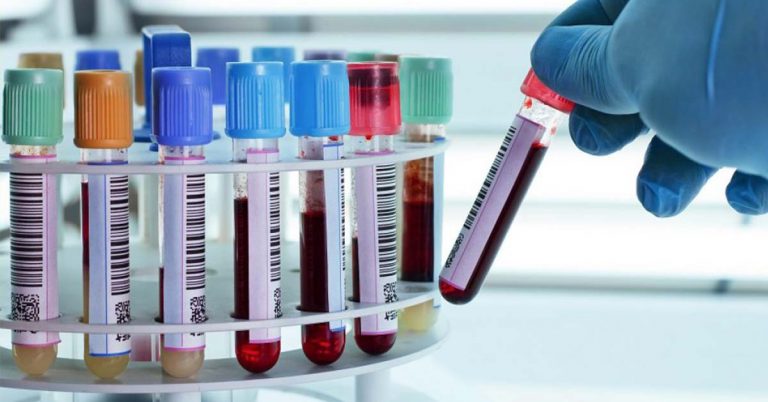 New Blood Test Accurately Determines the Threshold Dose for Reactions ...