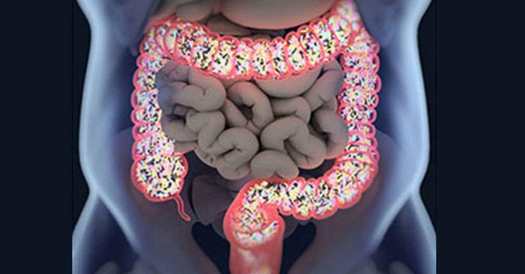 Study Shows New Triggers of Rare Food Allergy in Infants - SnackSafely.com