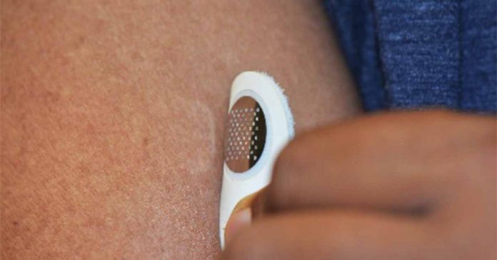 New Microneedle Patch Therapy for Food Allergies Takes Step Forward ...