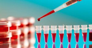 Recent Trial of Basophil Activation Test Near 100% Accurate at ...