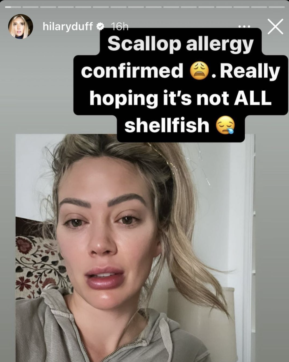 Hilary Duff Finds She is Allergic to Scallops — But Are They a Top 9 ...