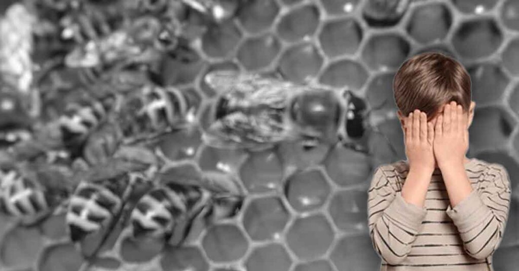 You Be the Judge: Bee Keeper vs Allergic Boy - SnackSafely.com